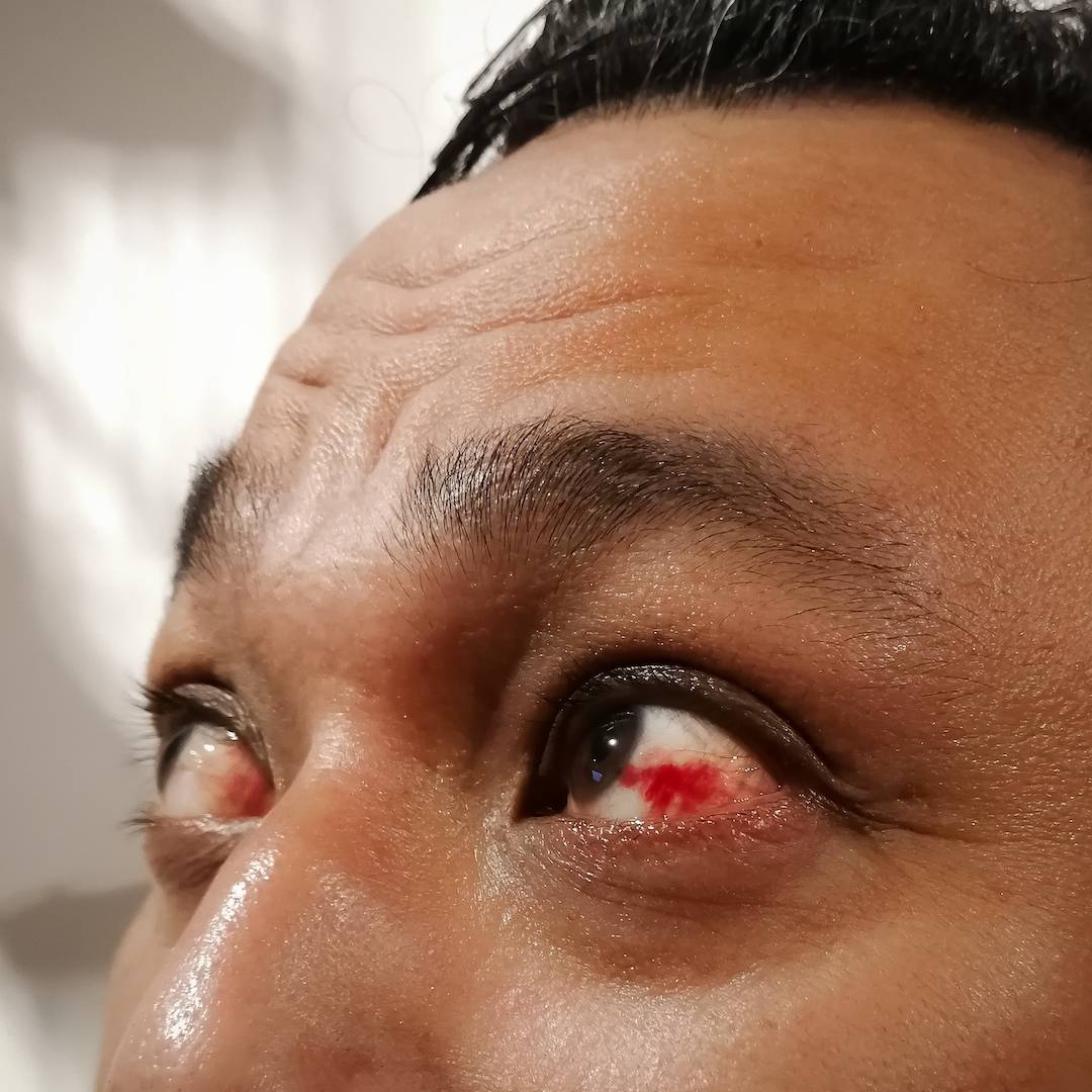 Emergency Care - See Family Eyecare